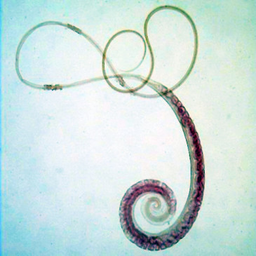 Trichuris - BioBalance
